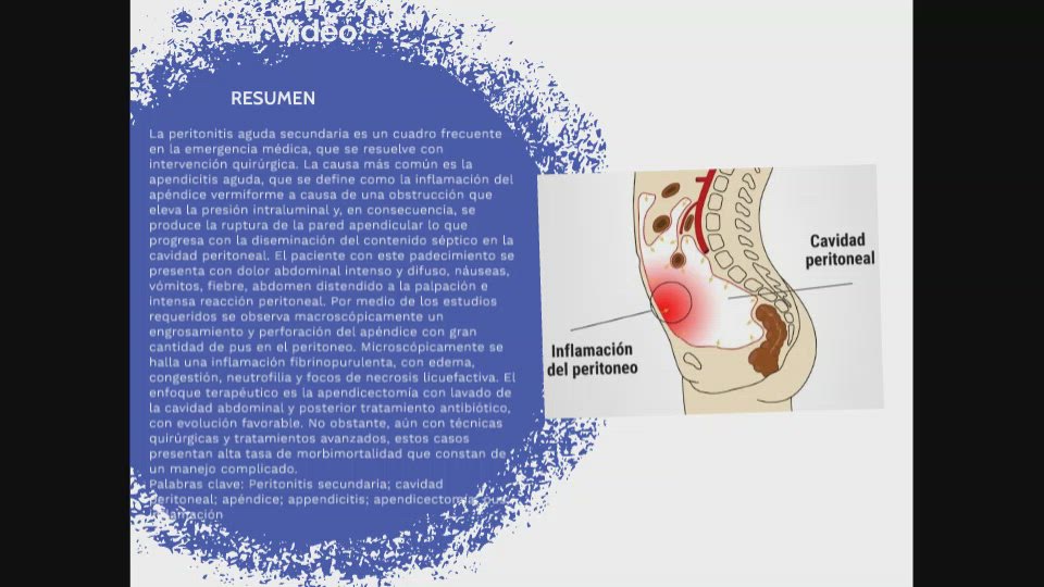 Peritonitis aguda by Juan Ramirez on Prezi Video