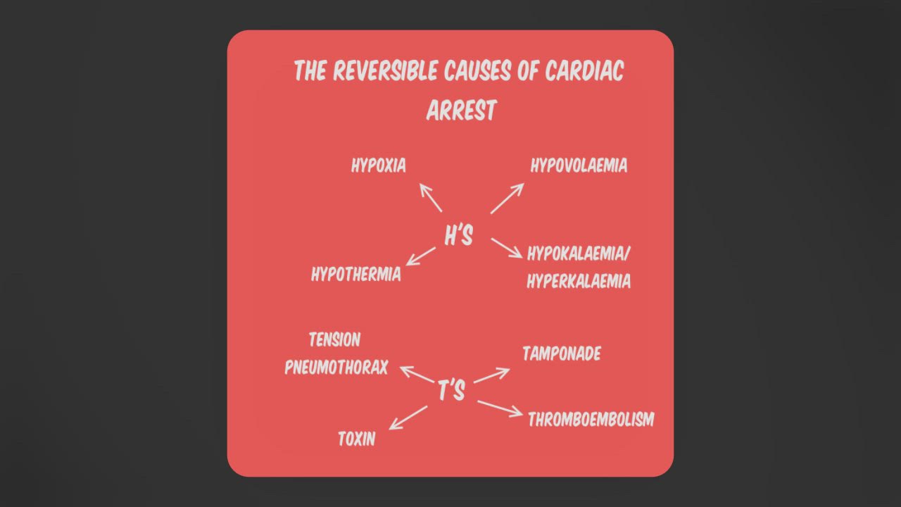 reversible causes of cardiac arrest by Shiv Sharma on Prezi Video