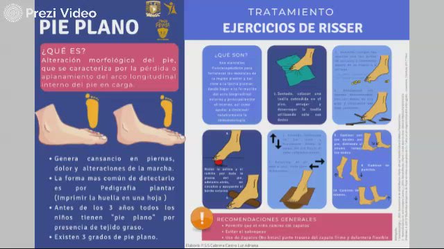 Ejercicios de Risser by Adriana Cabrera on Prezi Video