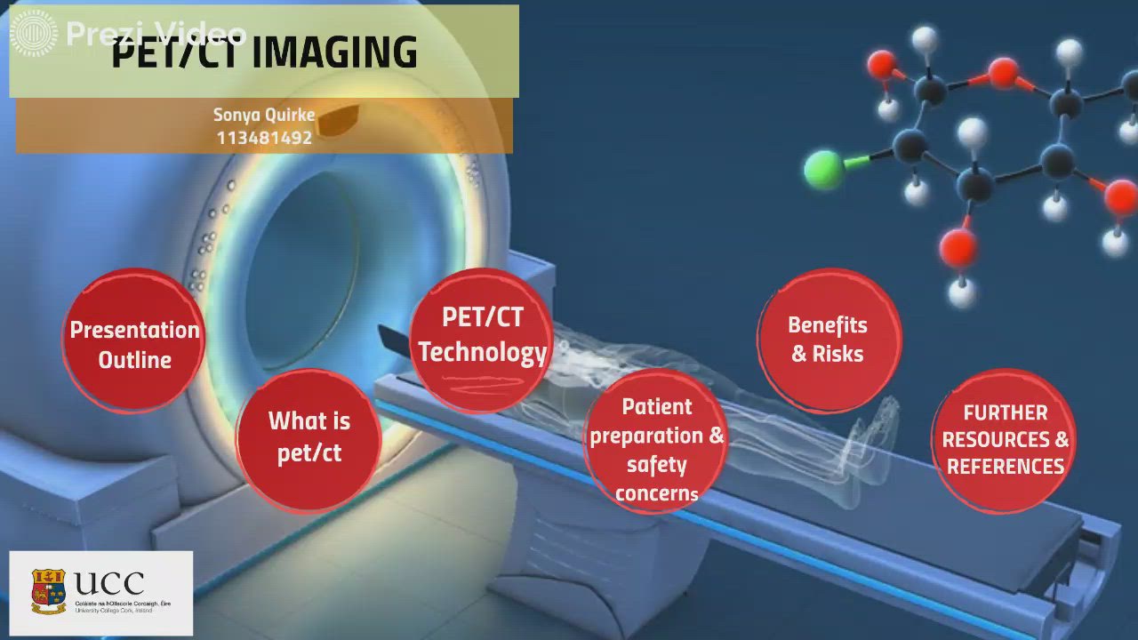 pt-ct-patient-presentation-by-sonya-quirke-on-prezi-video