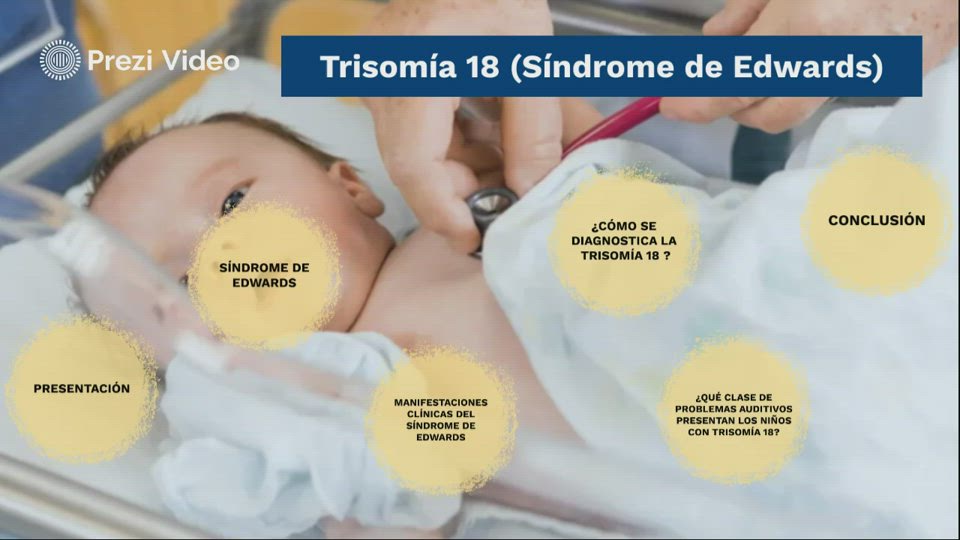 Trisomía 18 (Síndrome de Edwards) by Oscar Rodríguez on Prezi Video
