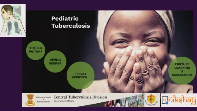 Pediatric Tuberculosis by Vaishnavi Raman on Prezi Video